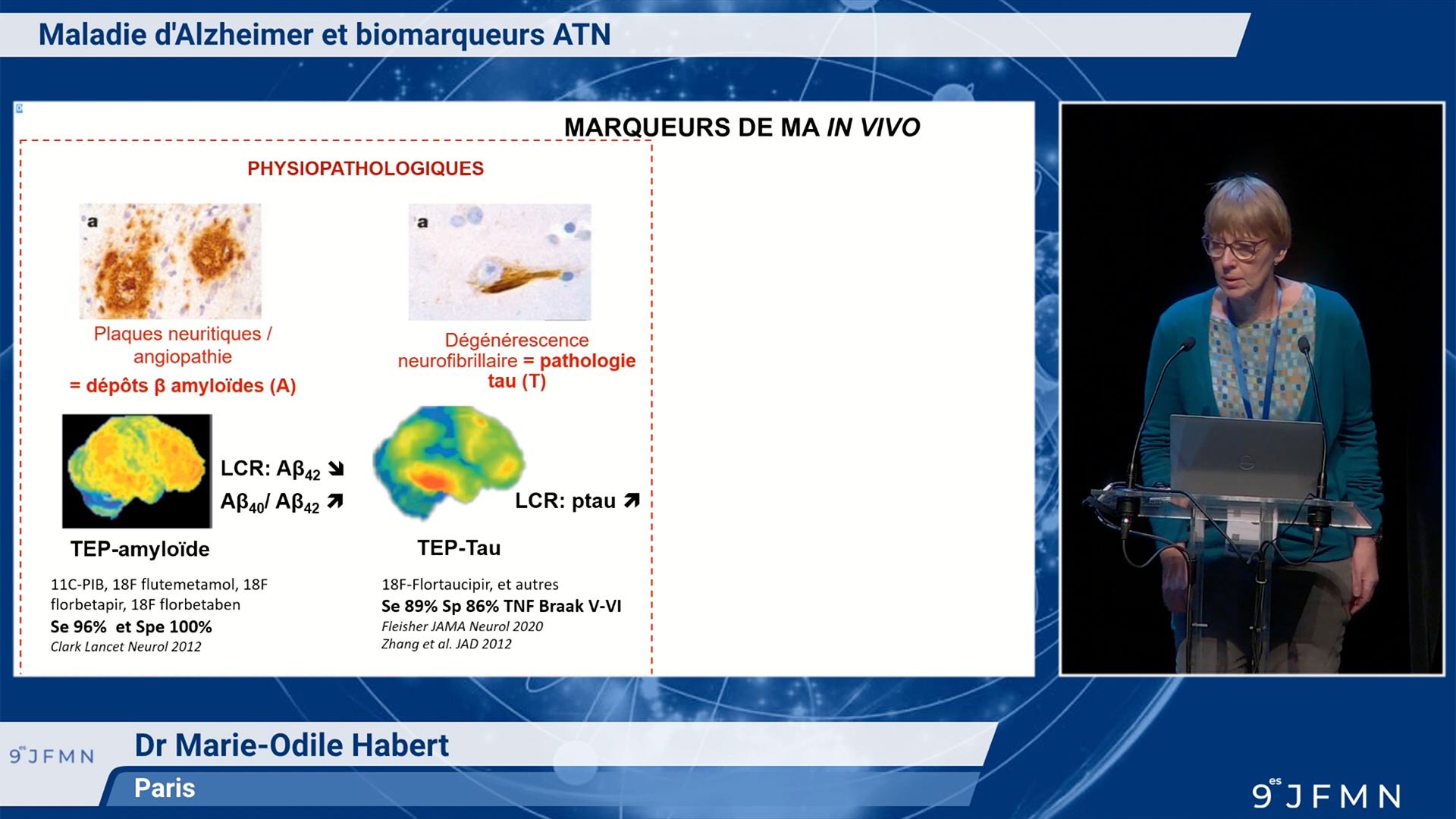 Vignette-JFMN_0003_Maladie-d-Alzheimer-et-biomarqueurs-ATN - Congrès JFMN