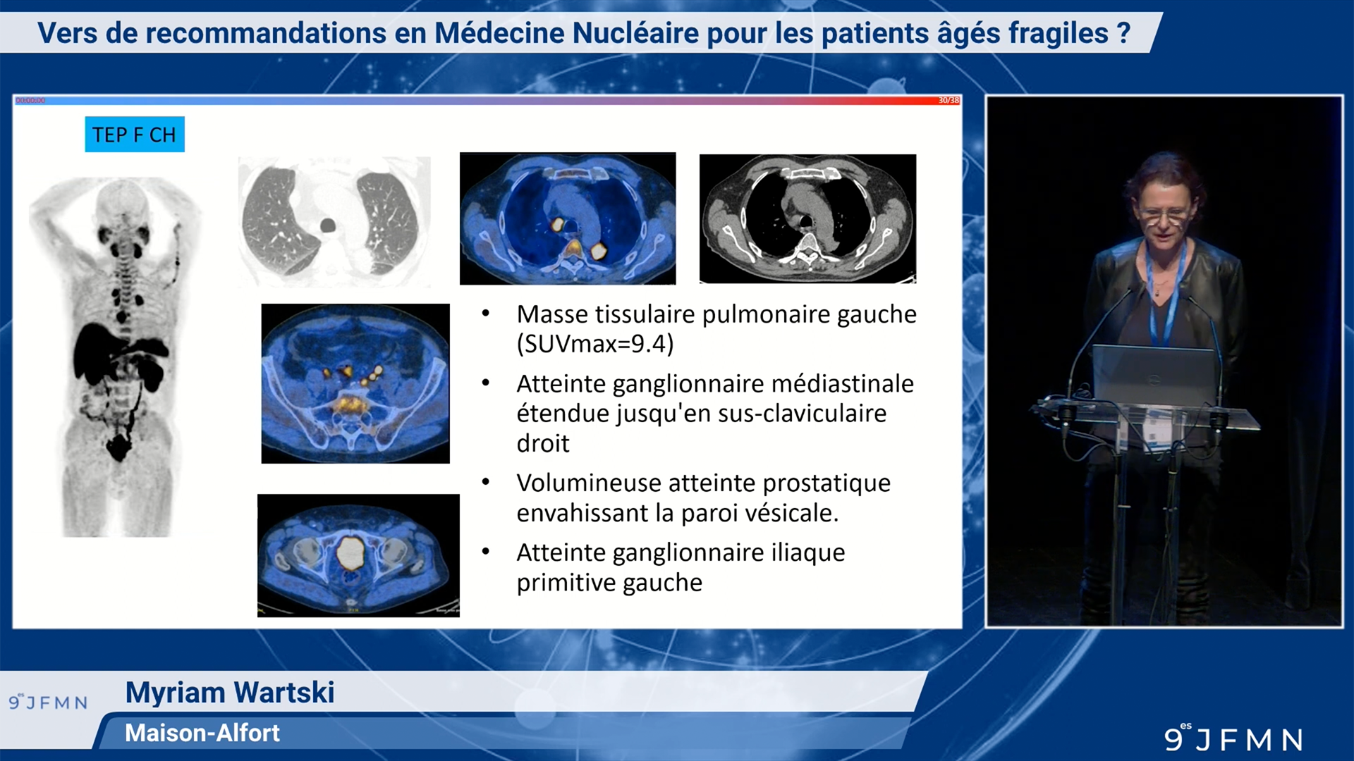 Vignette-JFMN_0007_Vers-de-recommandations-en-medecine-nucleaire-pour ...