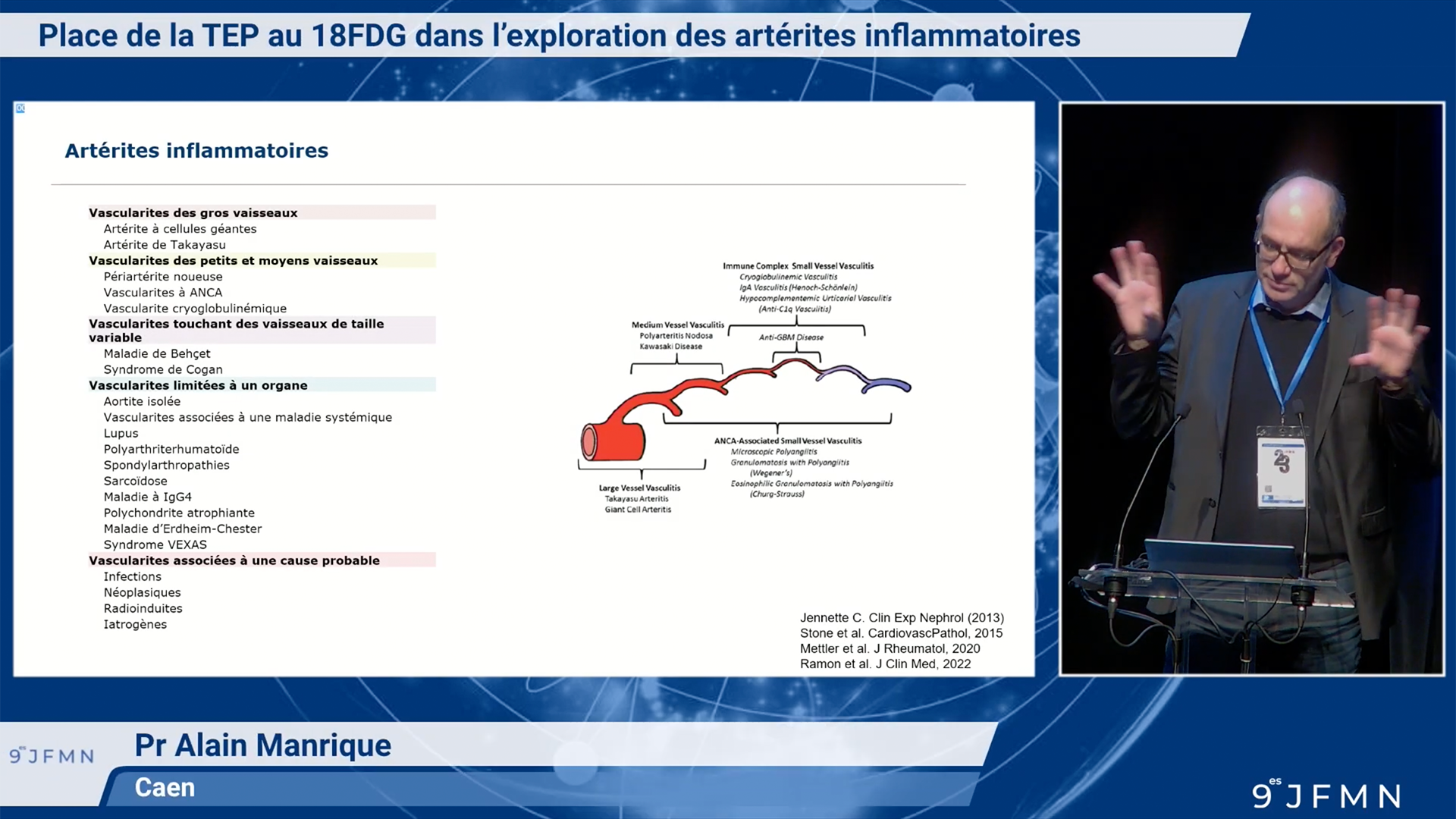 Vignette-JFMN_0016_Place-de-la-TED-au-18FDG-dans-l-exploration-des ...